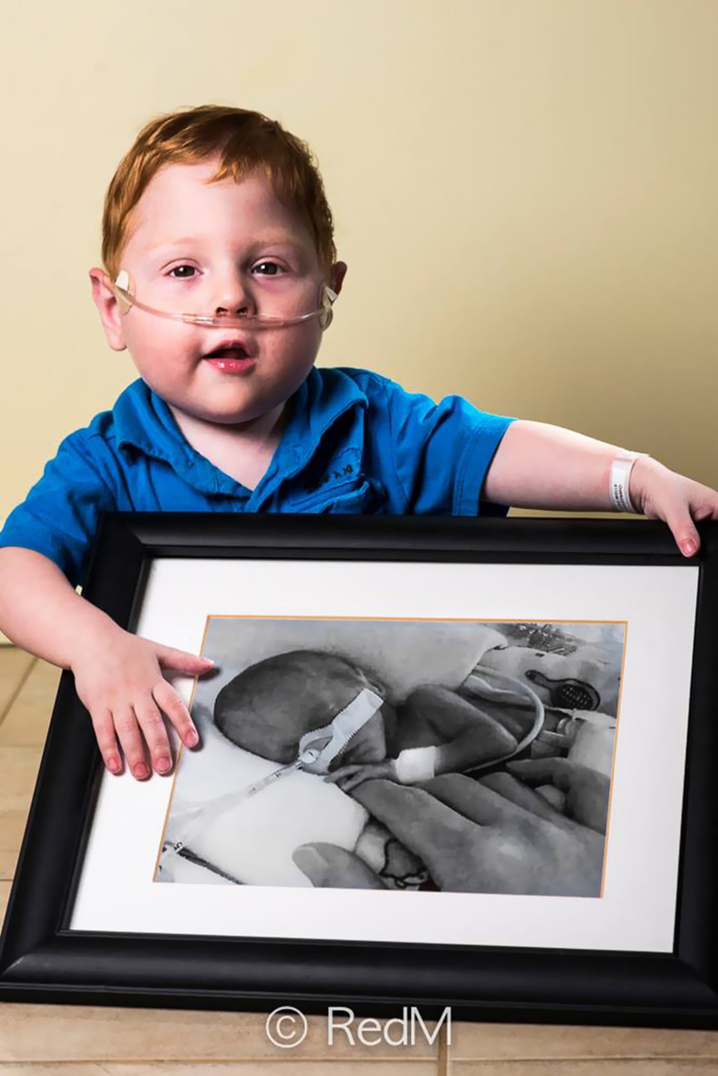 Then and Now Photos of Kids Who Were Born Premature | PS Family