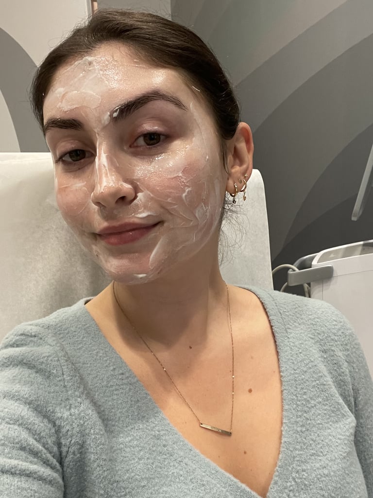 Clear + Brilliant Laser Treatment Review With Photos | POPSUGAR Beauty