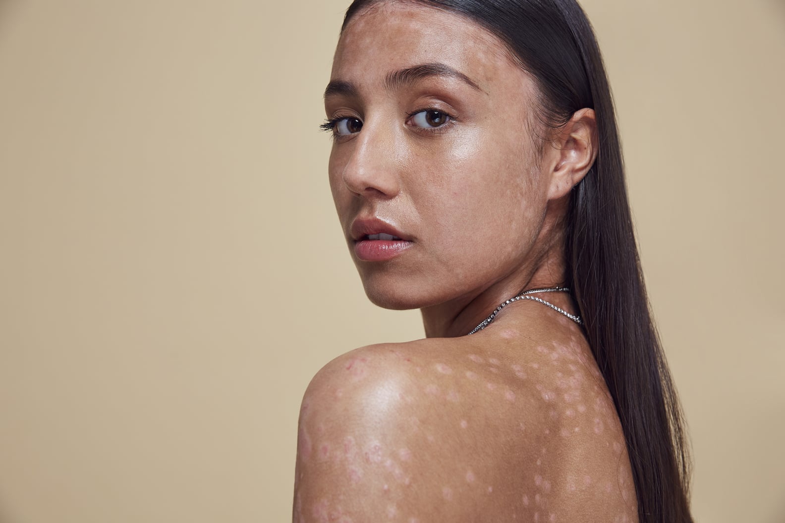 Missguided In Your Own Skin Campaign 2018 | PS Fashion