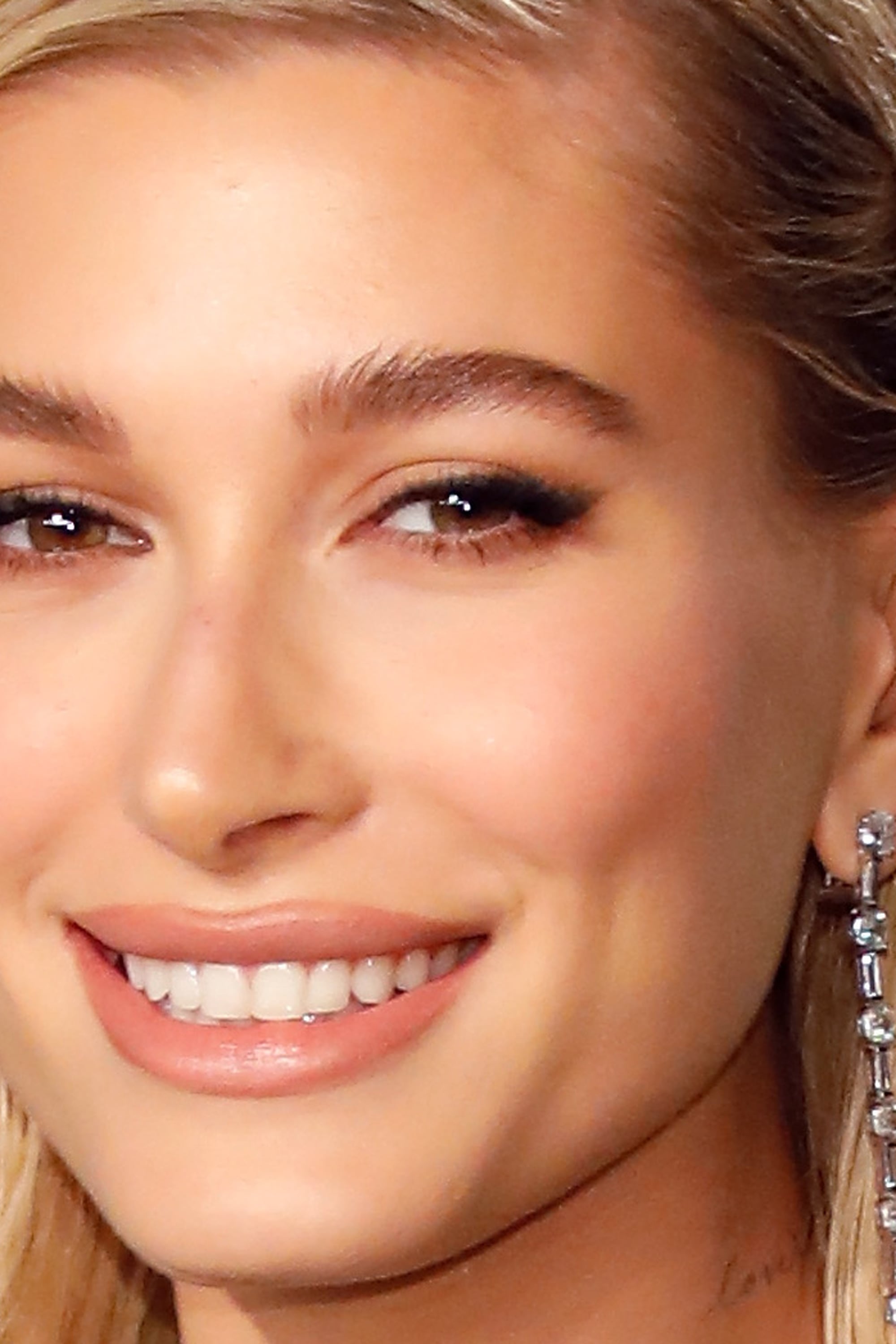 Hailey Bieber Opens Up Skin Condition, Perioral Dermatitis | POPSUGAR ...
