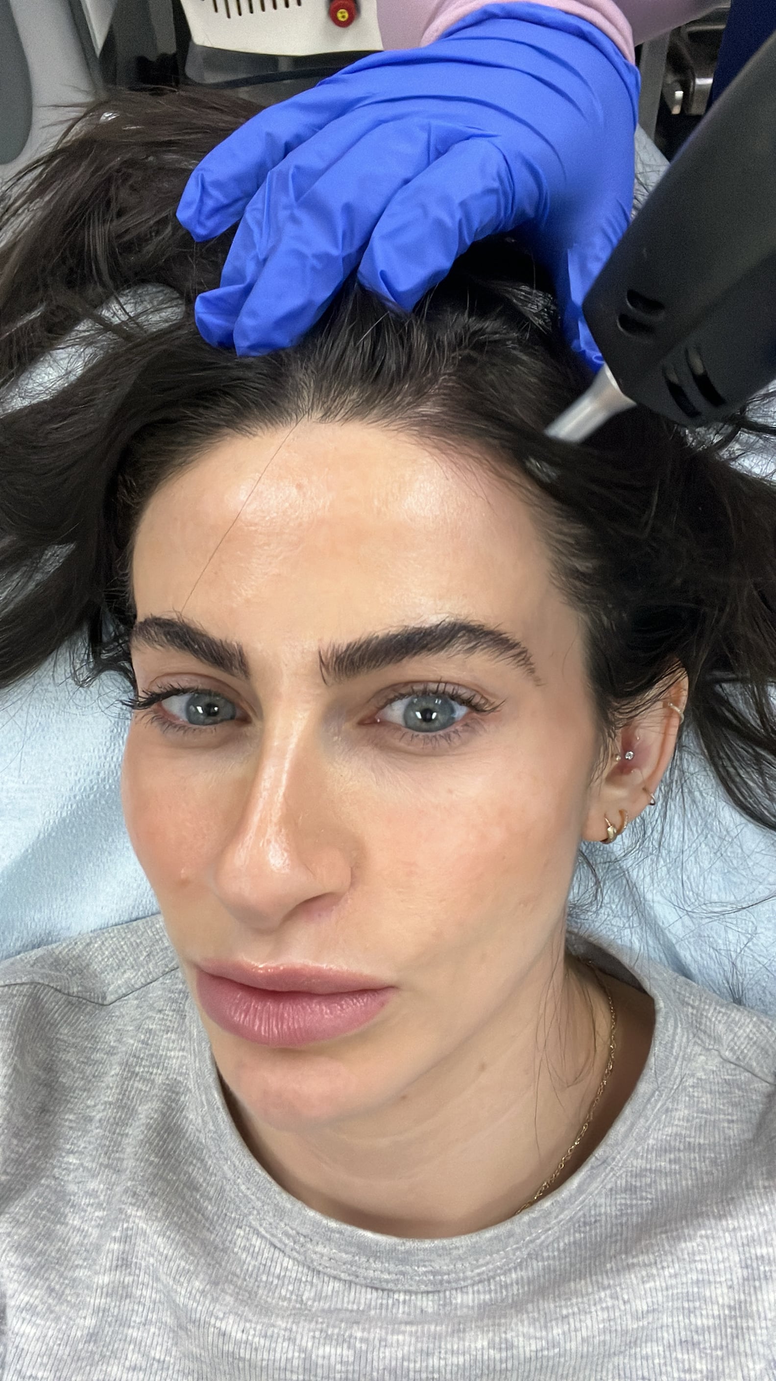 Alma TED Hair Treatment Review and Photos | PS Beauty