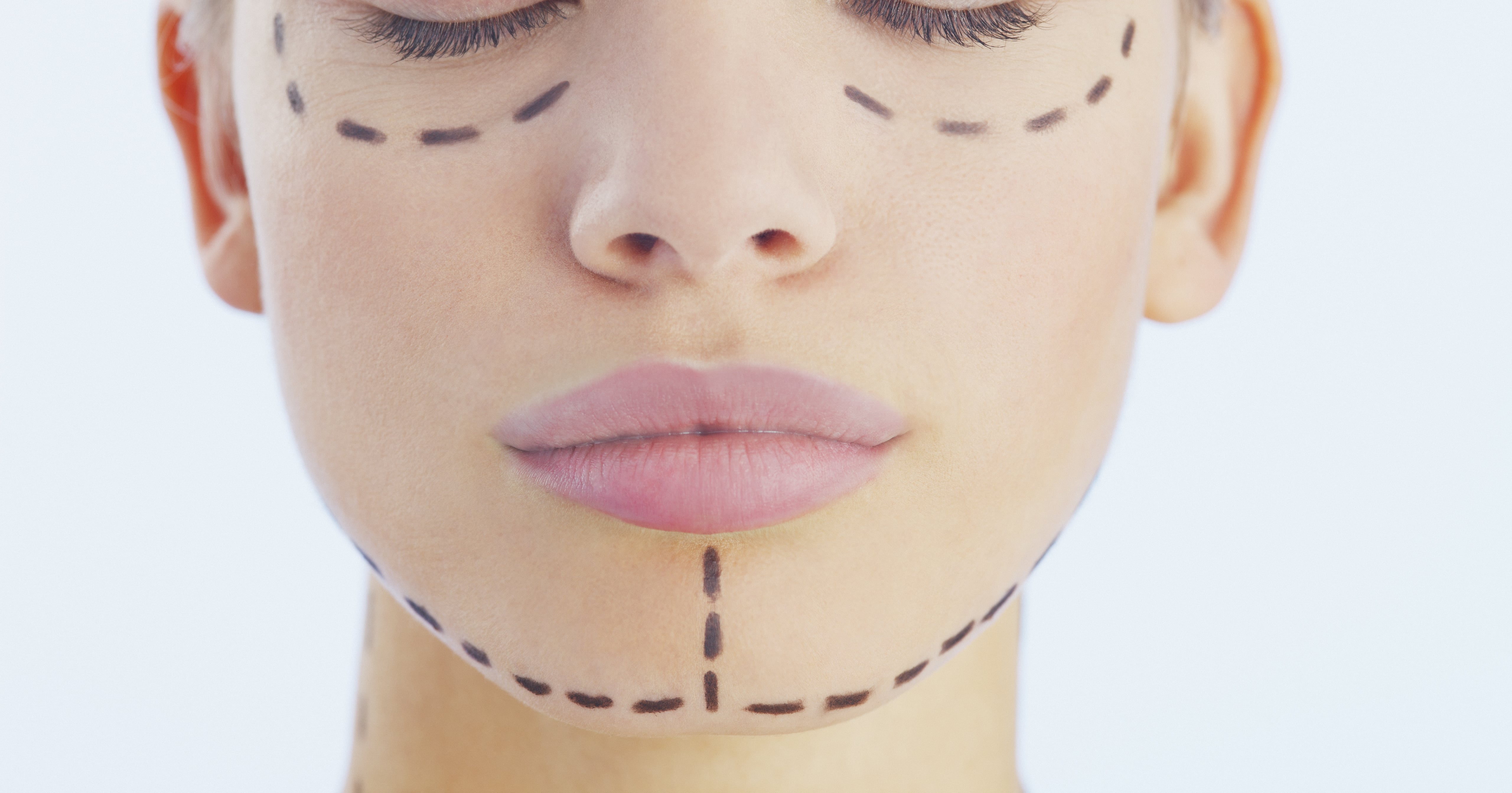 What to Know About Chin Augmentation, From a Plastic Surgeon | PS Beauty