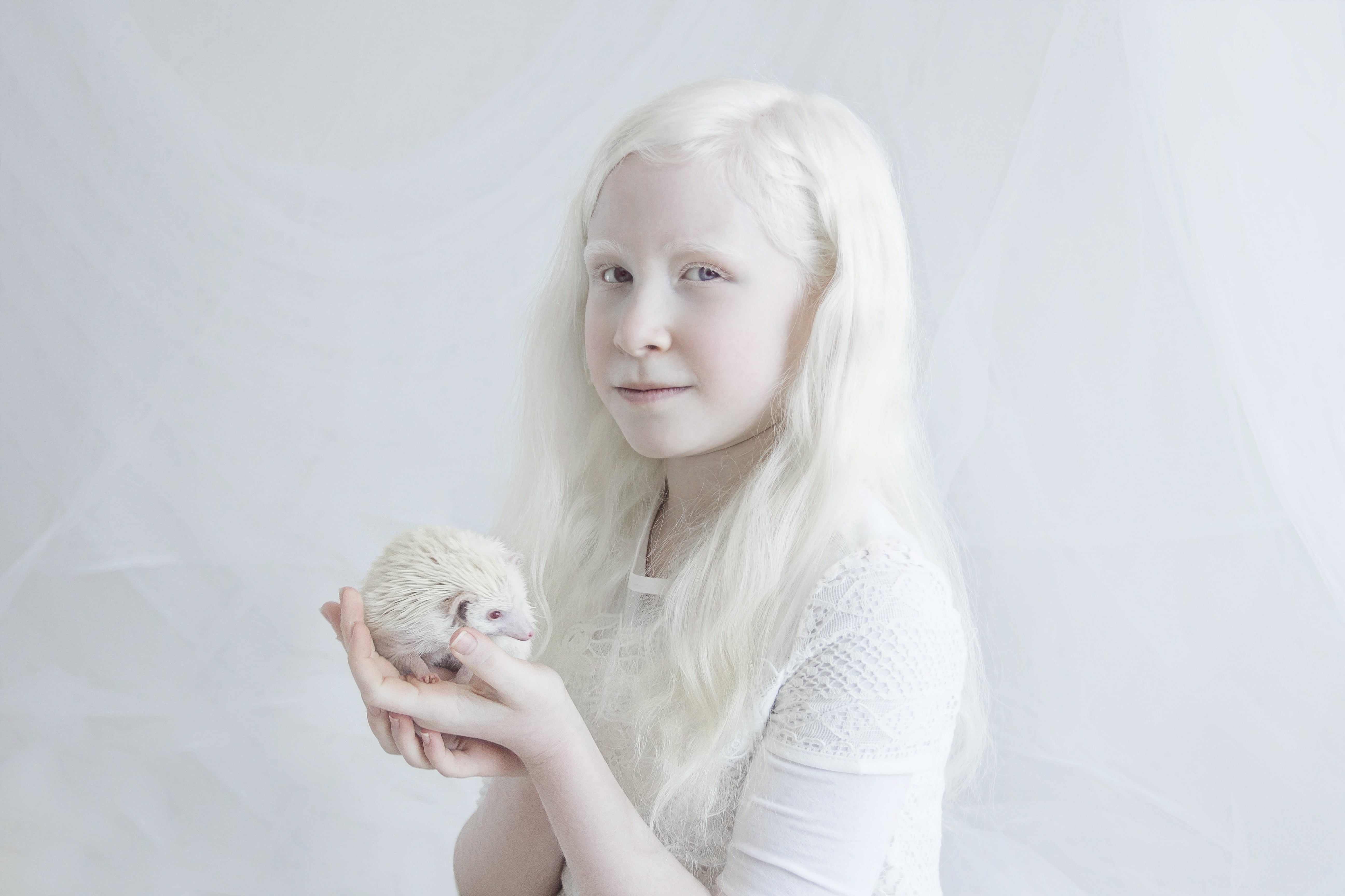 Beautiful People With Albinism