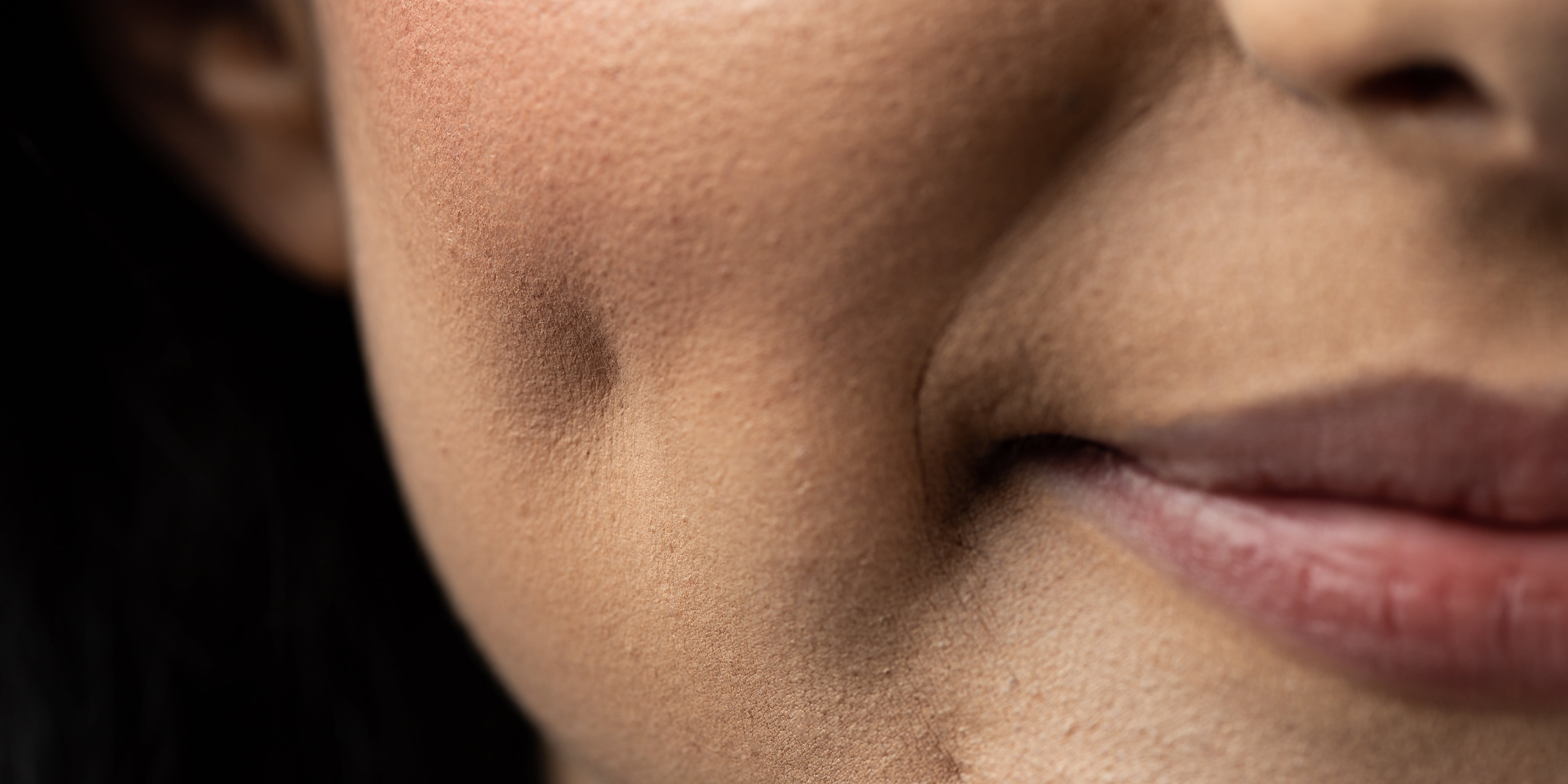 Dimpleplasty Surgery: Cost, Downtime, and Potential Risks | PS Beauty