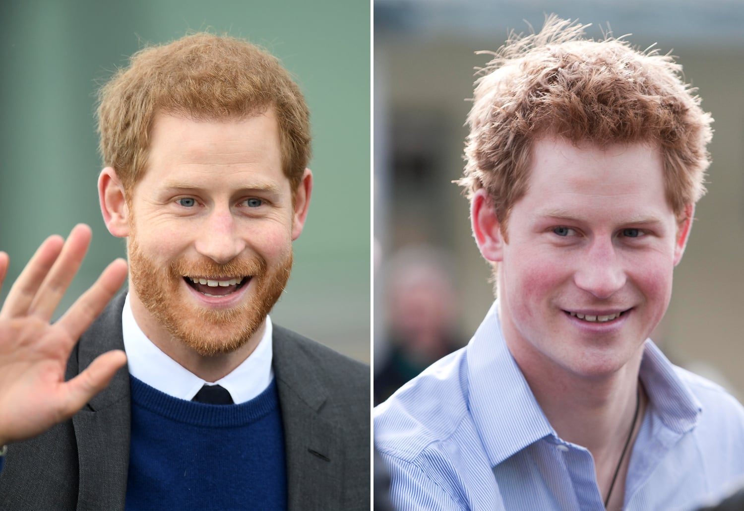 Prince Harry Beard