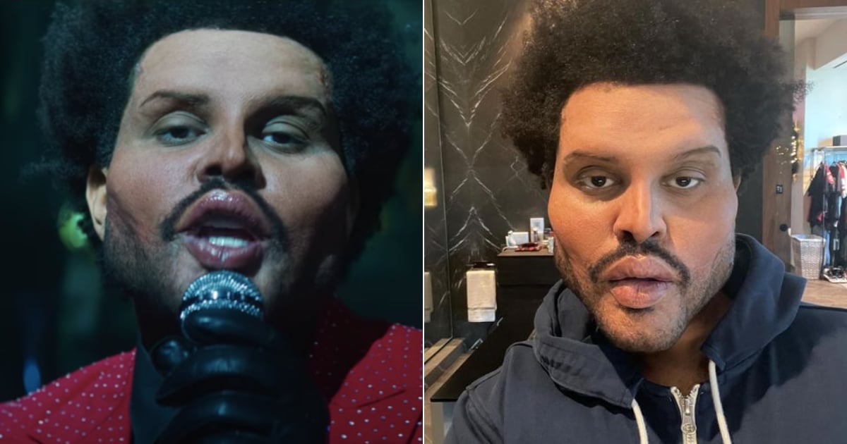 The Weeknd's Face Got a Plastic-Surgery Prosthetics Makeover | POPSUGAR ...