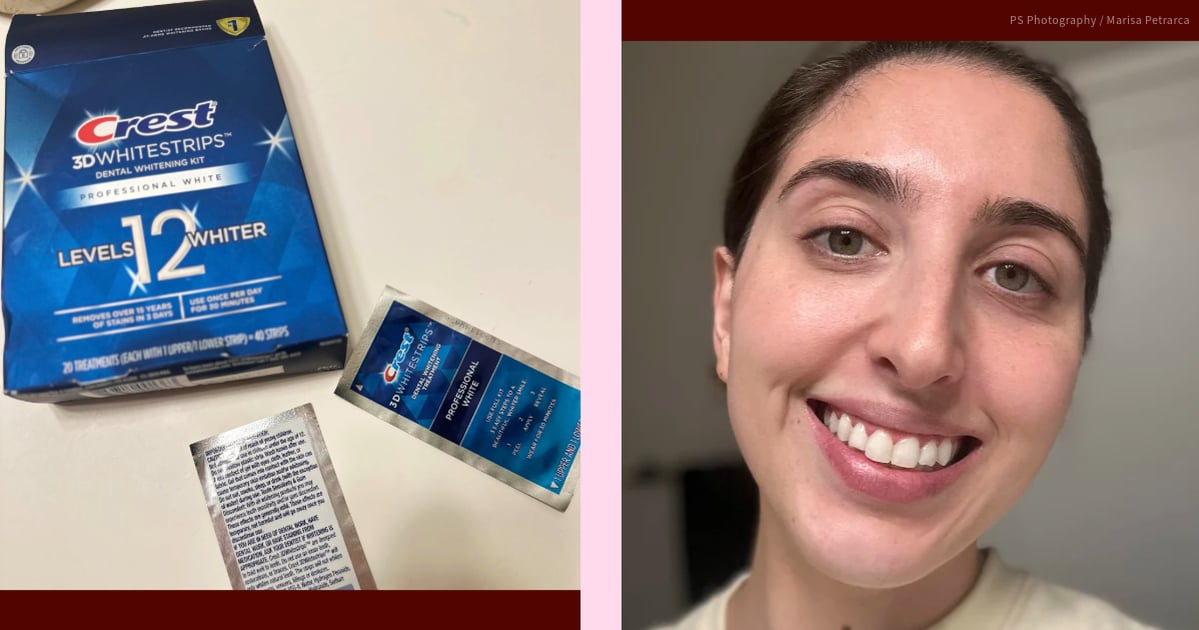 Crest Whitening Strips Review From a Beauty Editor | PS Beauty