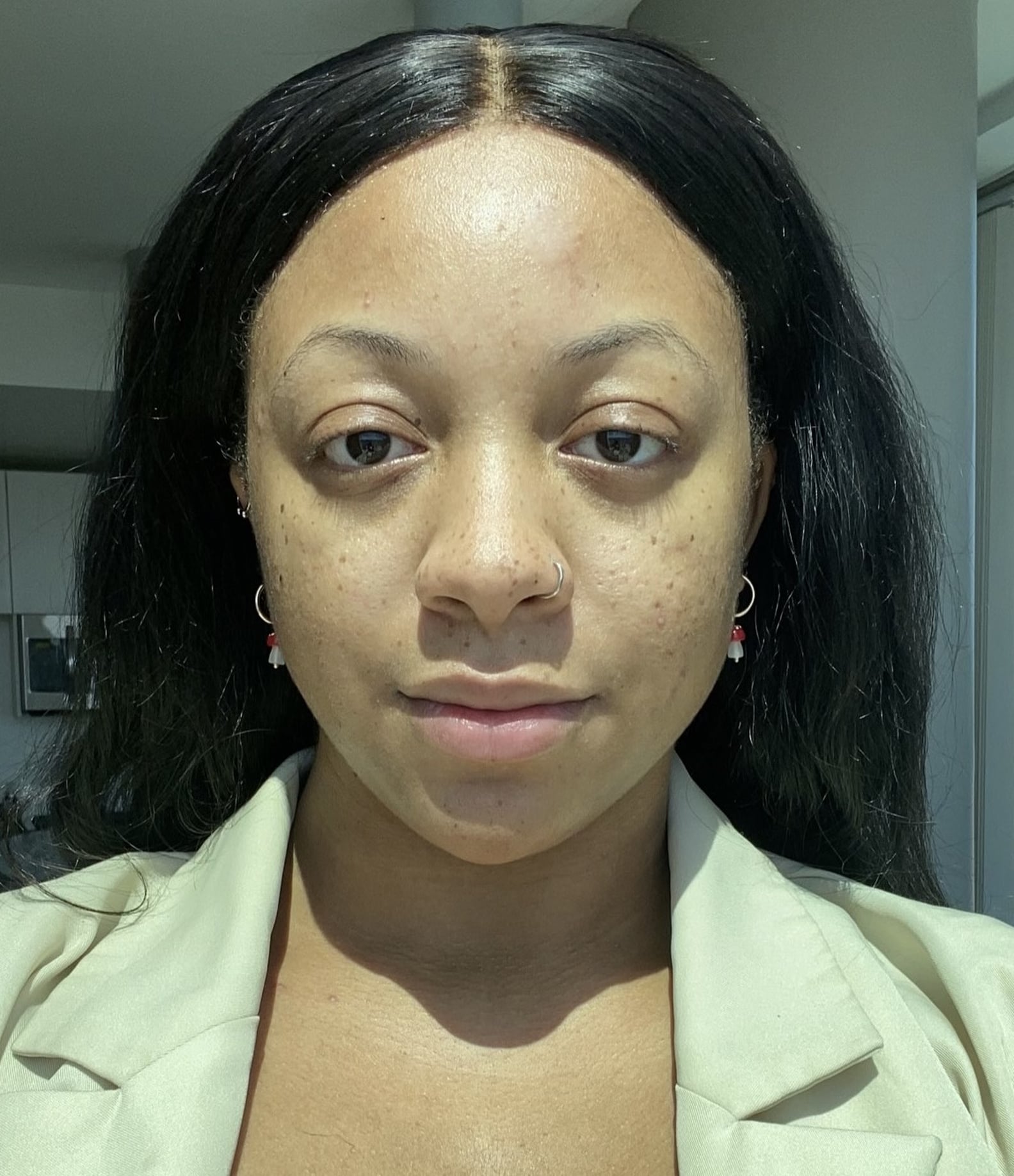 I Tried the Celebrity-Favorite Forma Facial Treatment | PS Beauty
