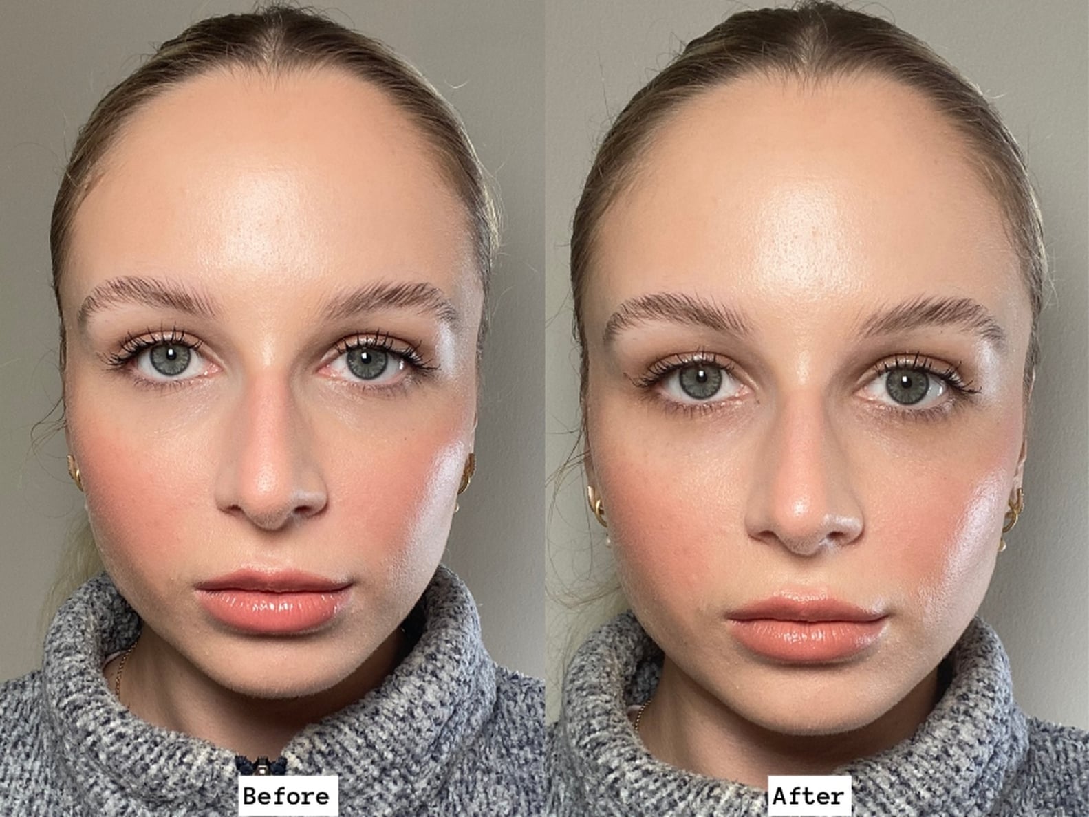 Upneeq Eye Drops Review With Photos | PS Beauty