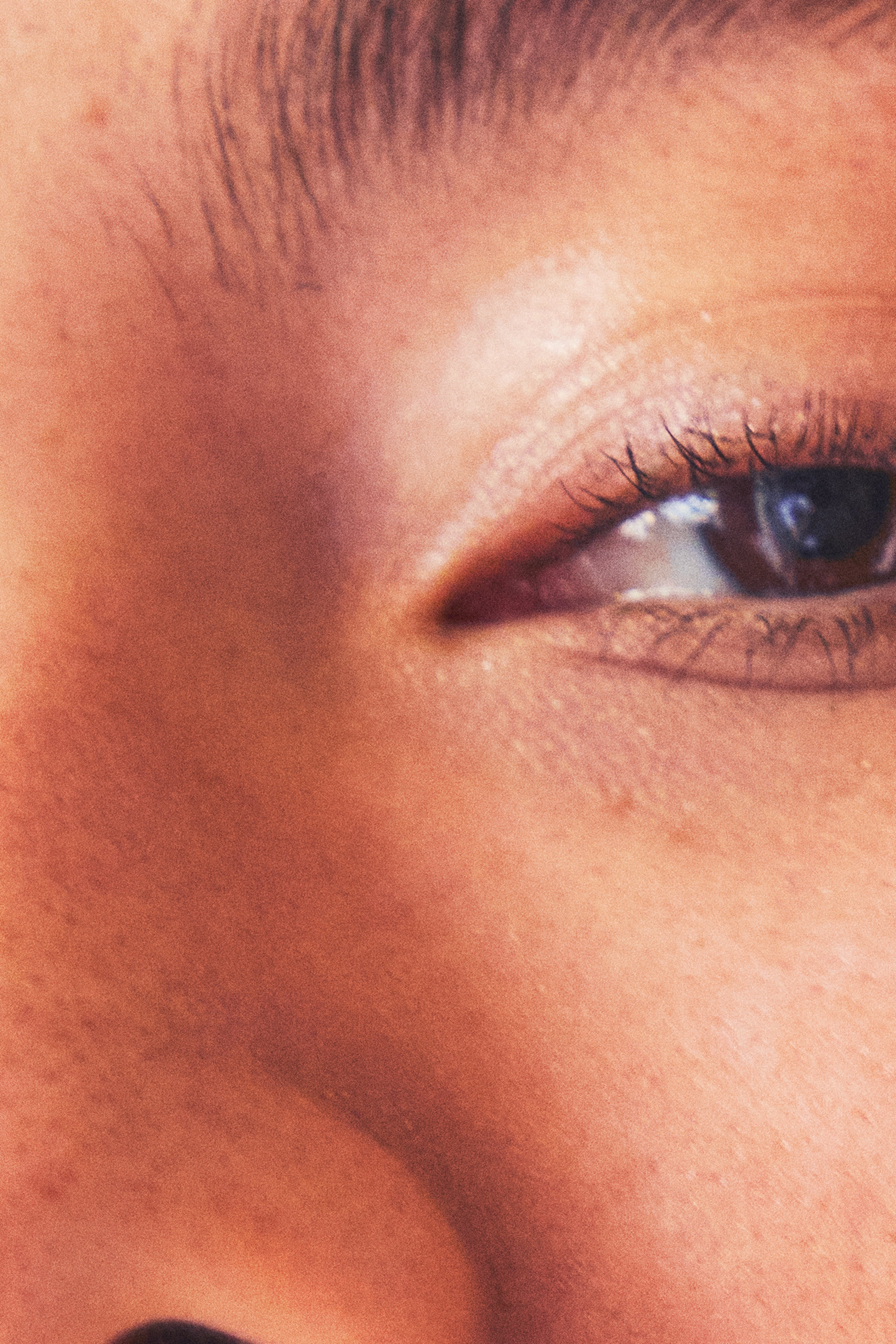 What Is Hypopigmentation? A Skin-Care Expert Explains | POPSUGAR Beauty