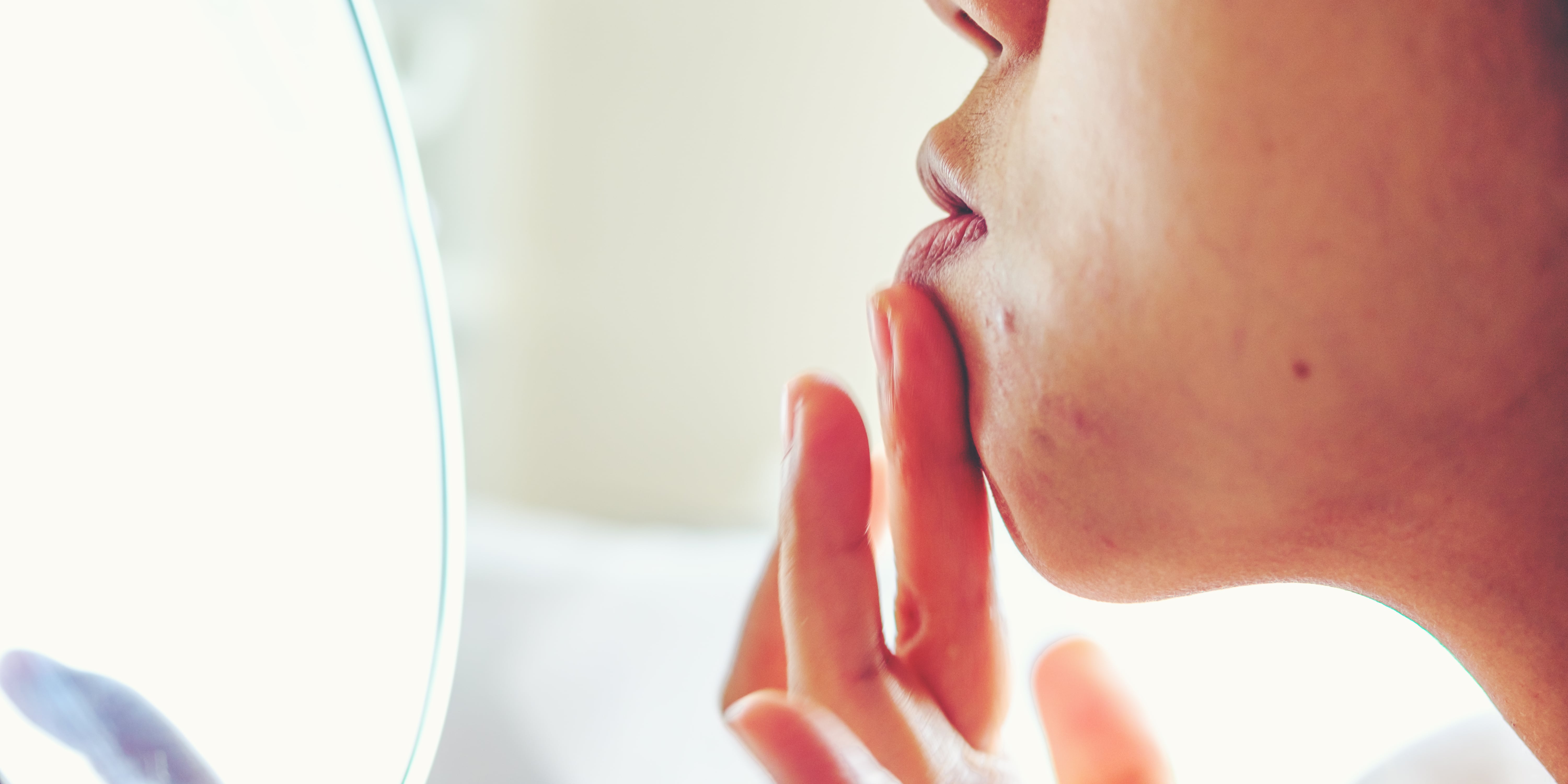 What to Do After Popping a Pimple: Tips and Treatments | PS Beauty