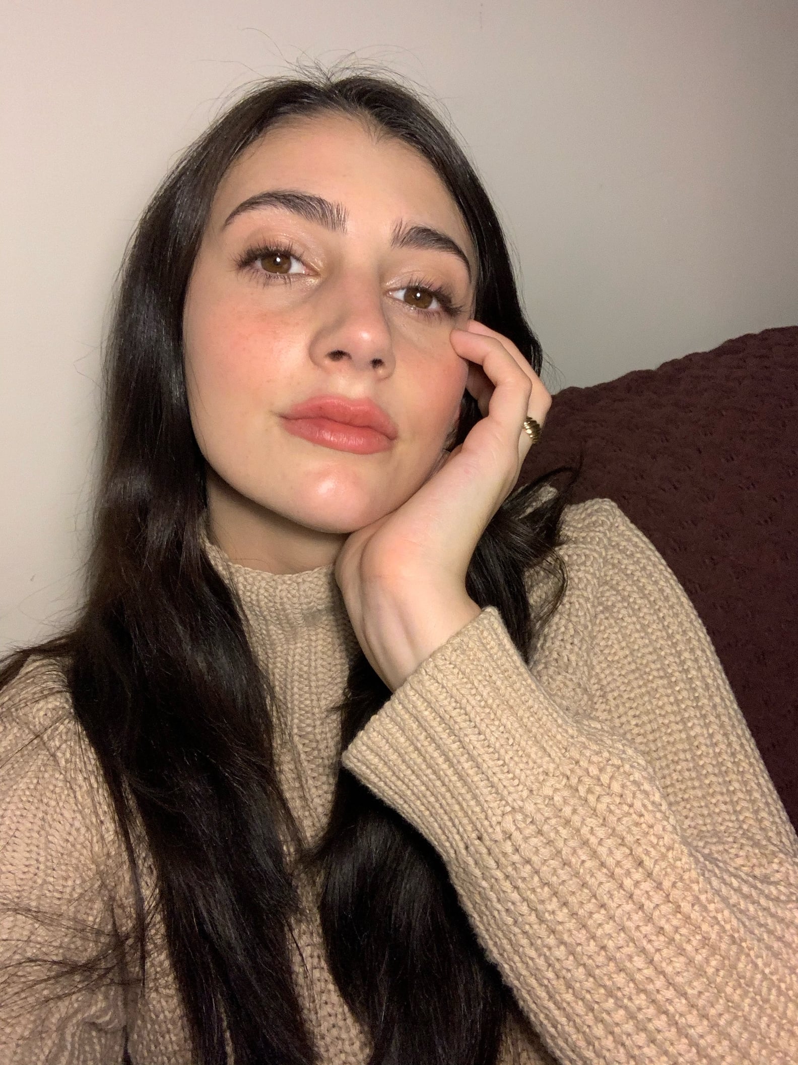 I Got Lip Filler: See the Before and Afters | PS UK Beauty