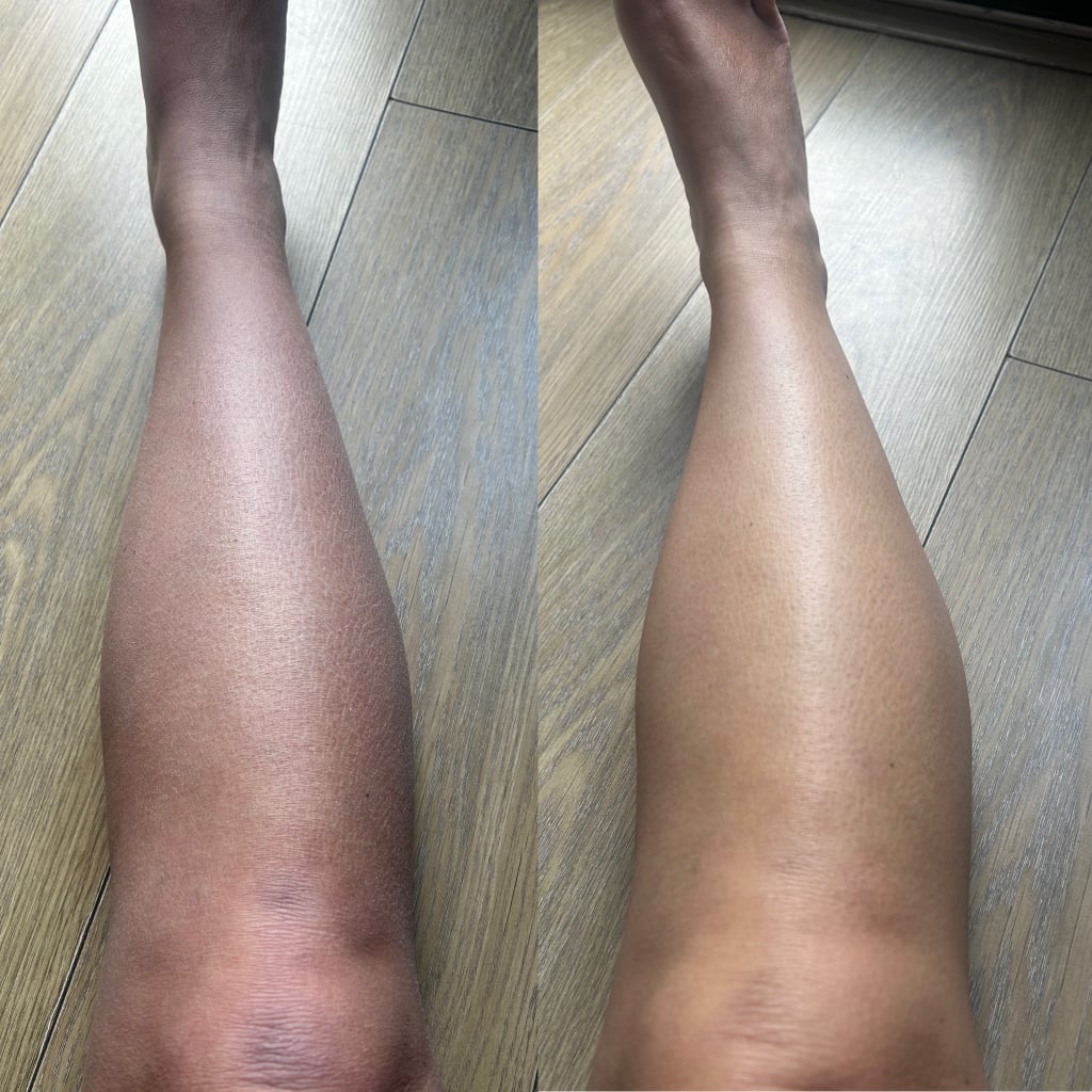 I Tried The Inkey List Body Stick: The Results Blew Me Away | POPSUGAR ...