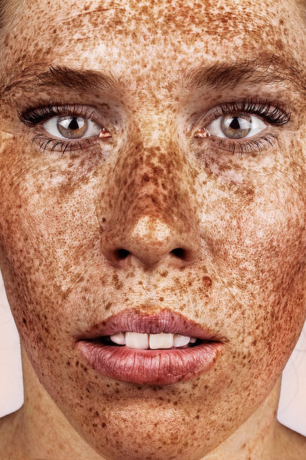 Photos of People With Freckles | PS Beauty
