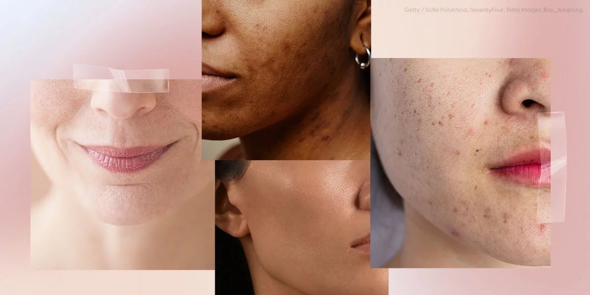 Skin Type Quiz: What Is Your Skin Type? | POPSUGAR Beauty