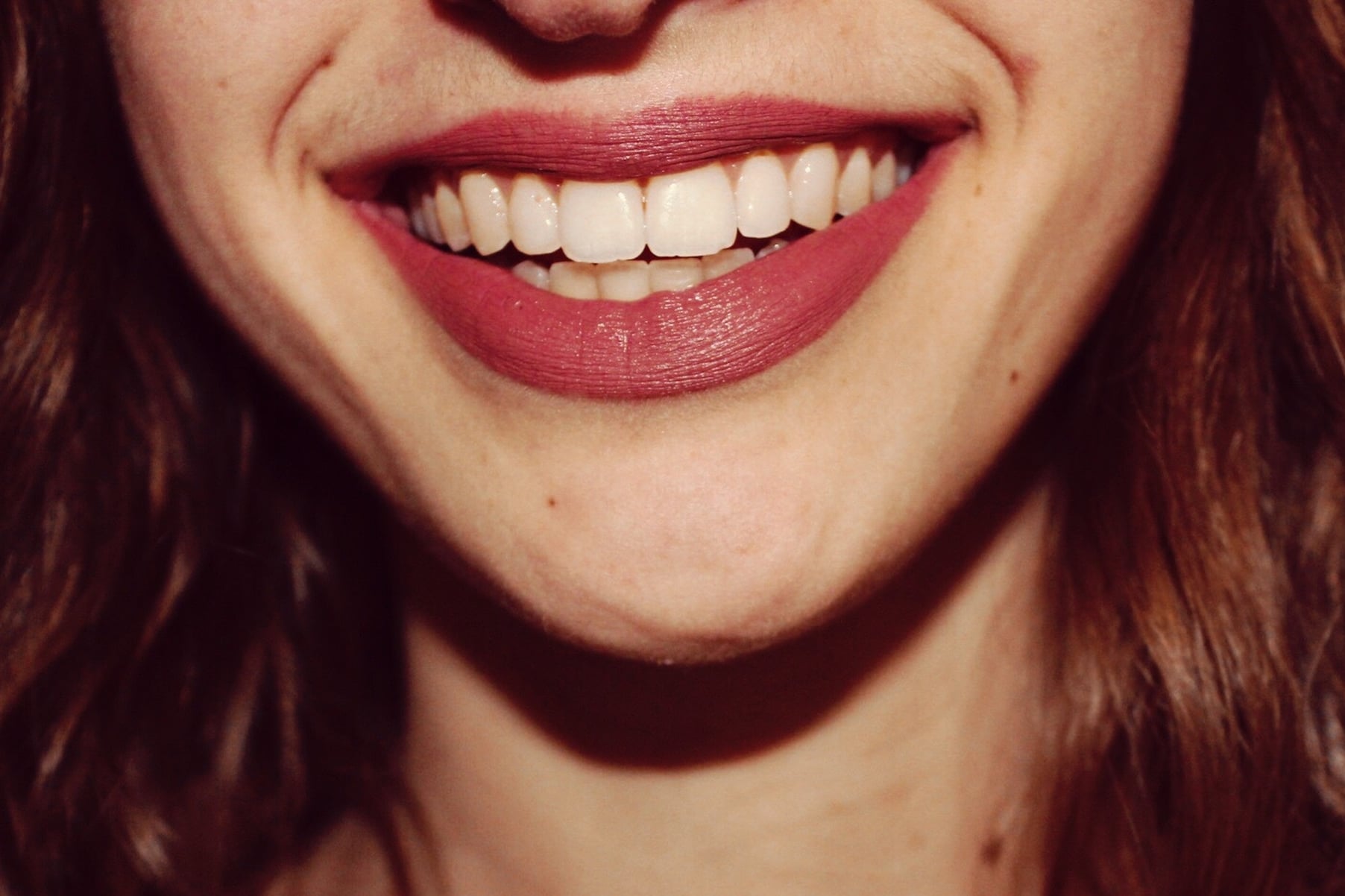 TikTok's Teeth-Filing Trend Can Cause Serious Damage | POPSUGAR Beauty