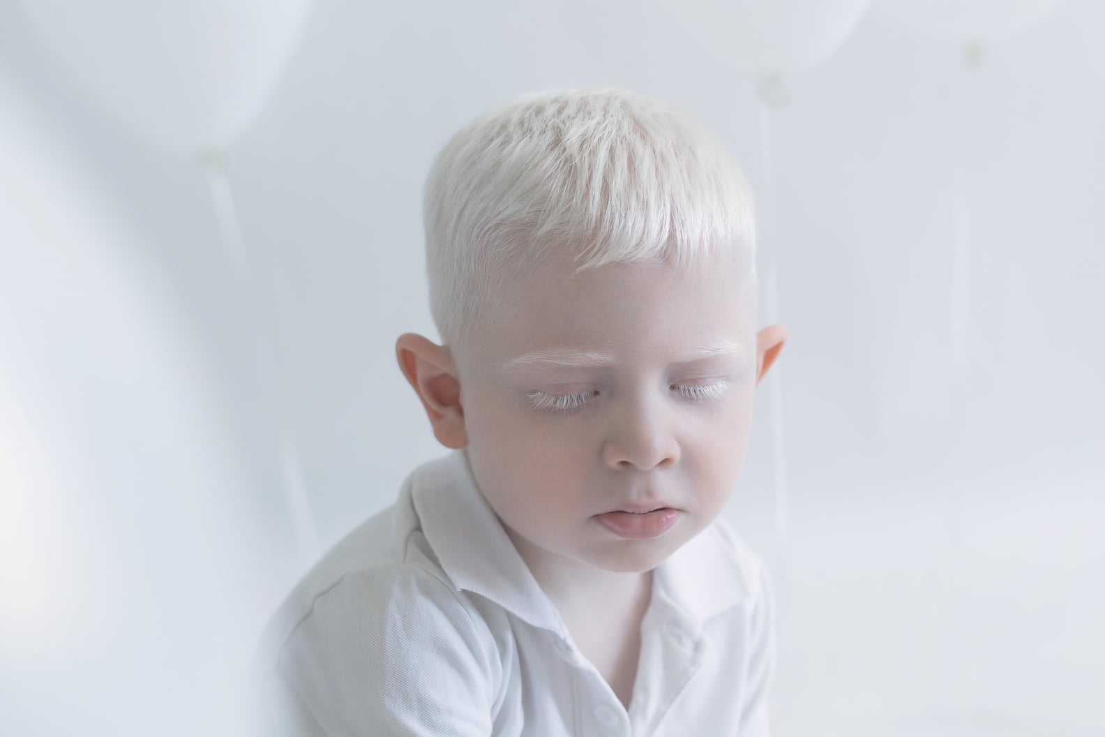 Albinism Photographs | Yulia Taits | PS Beauty