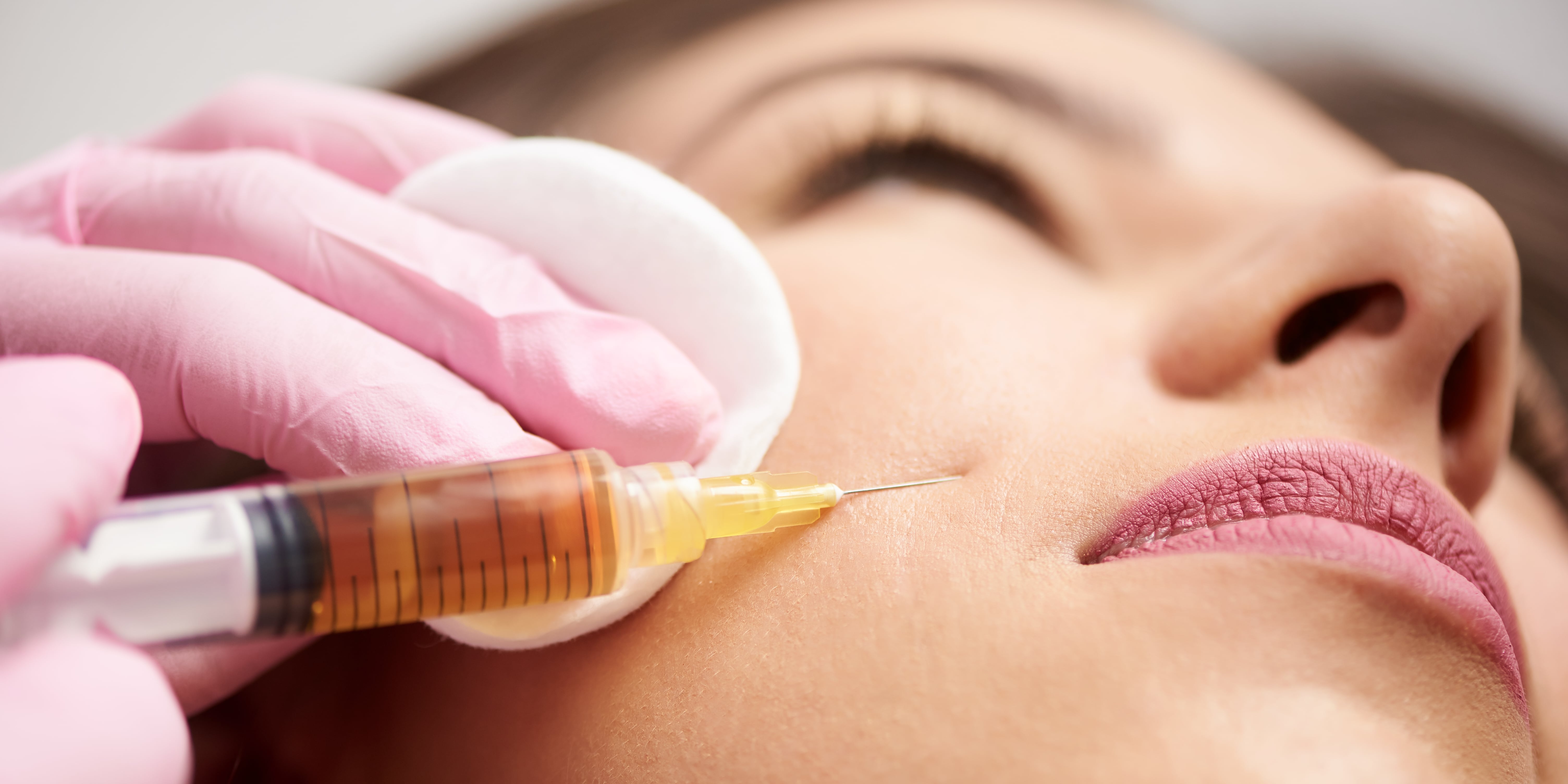 What to Know About Cheek Filler: Cost, Benefits, Pain | POPSUGAR Beauty