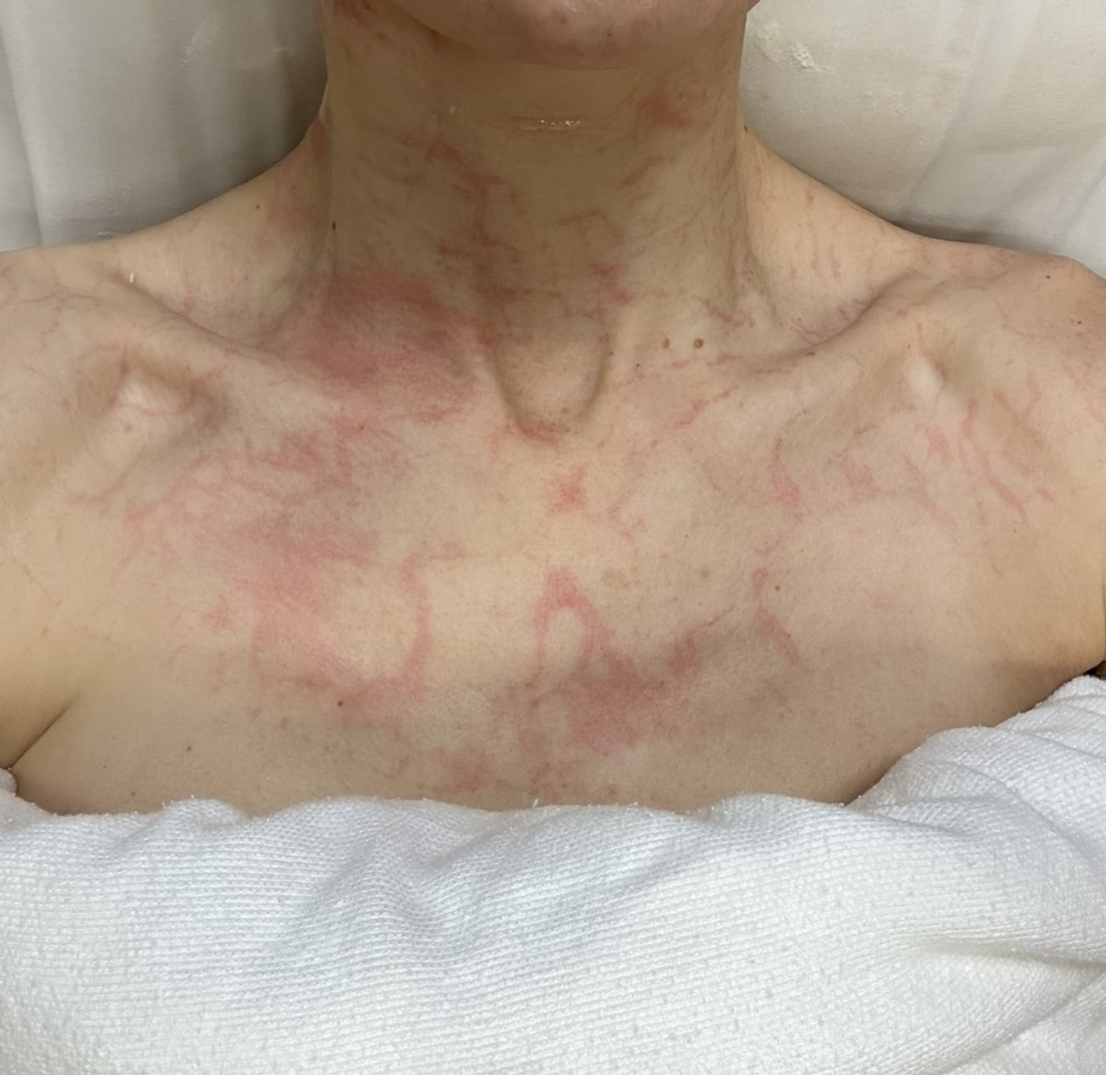 I Got a Zombie Facial: See Photos | PS Beauty