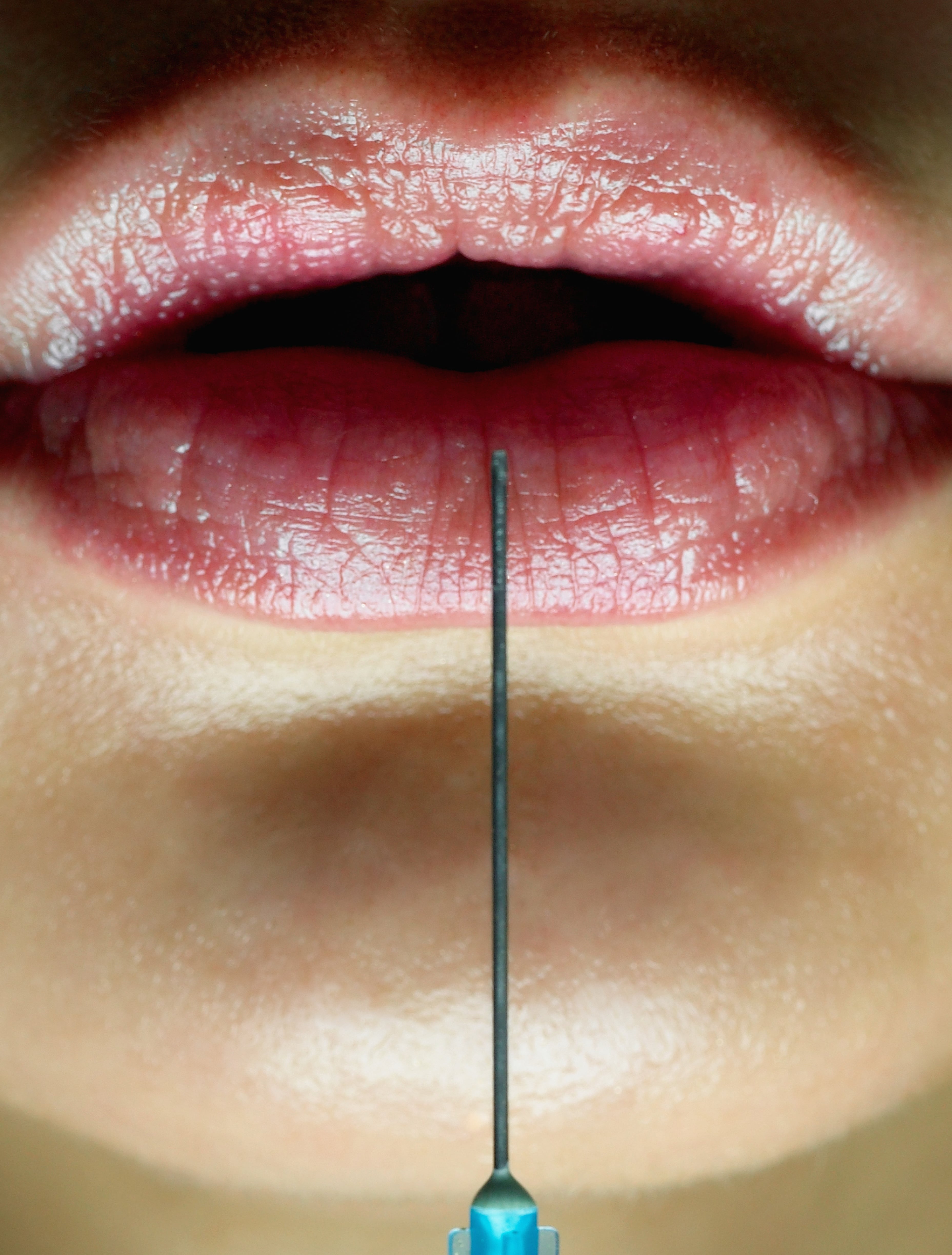 I Got A Lip Flip, TikTok's Lip-Filler Alternative | POPSUGAR Beauty