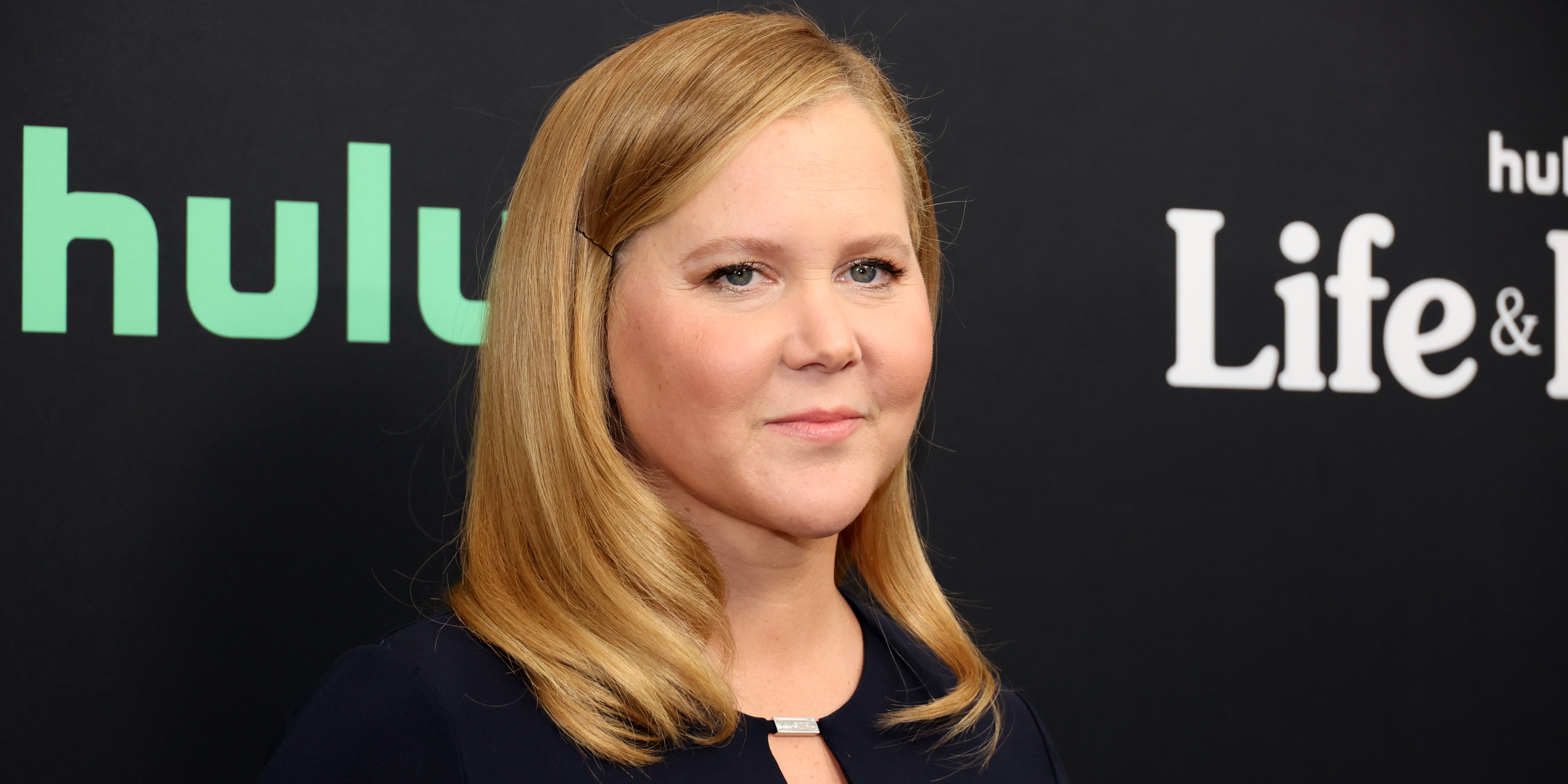 Amy Schumer Reveals Hair Pulling Disorder Trichotillomania Ps Fitness