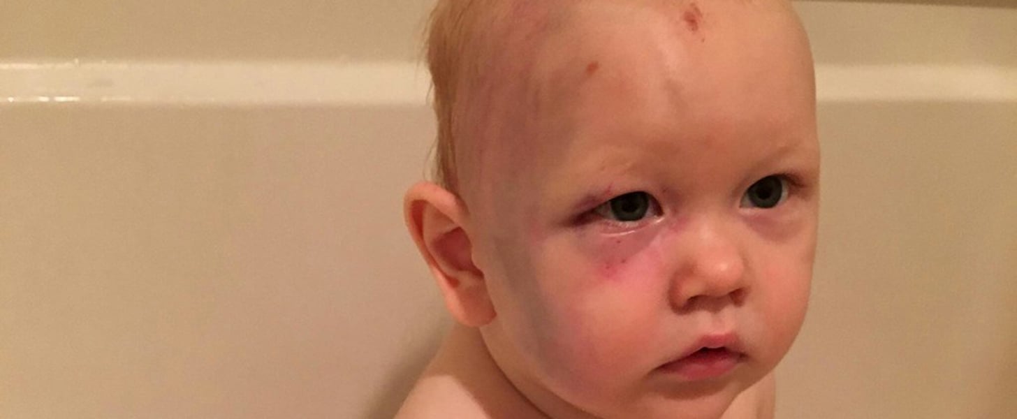 Babysitter Gets Away With Abusing Baby | POPSUGAR Family