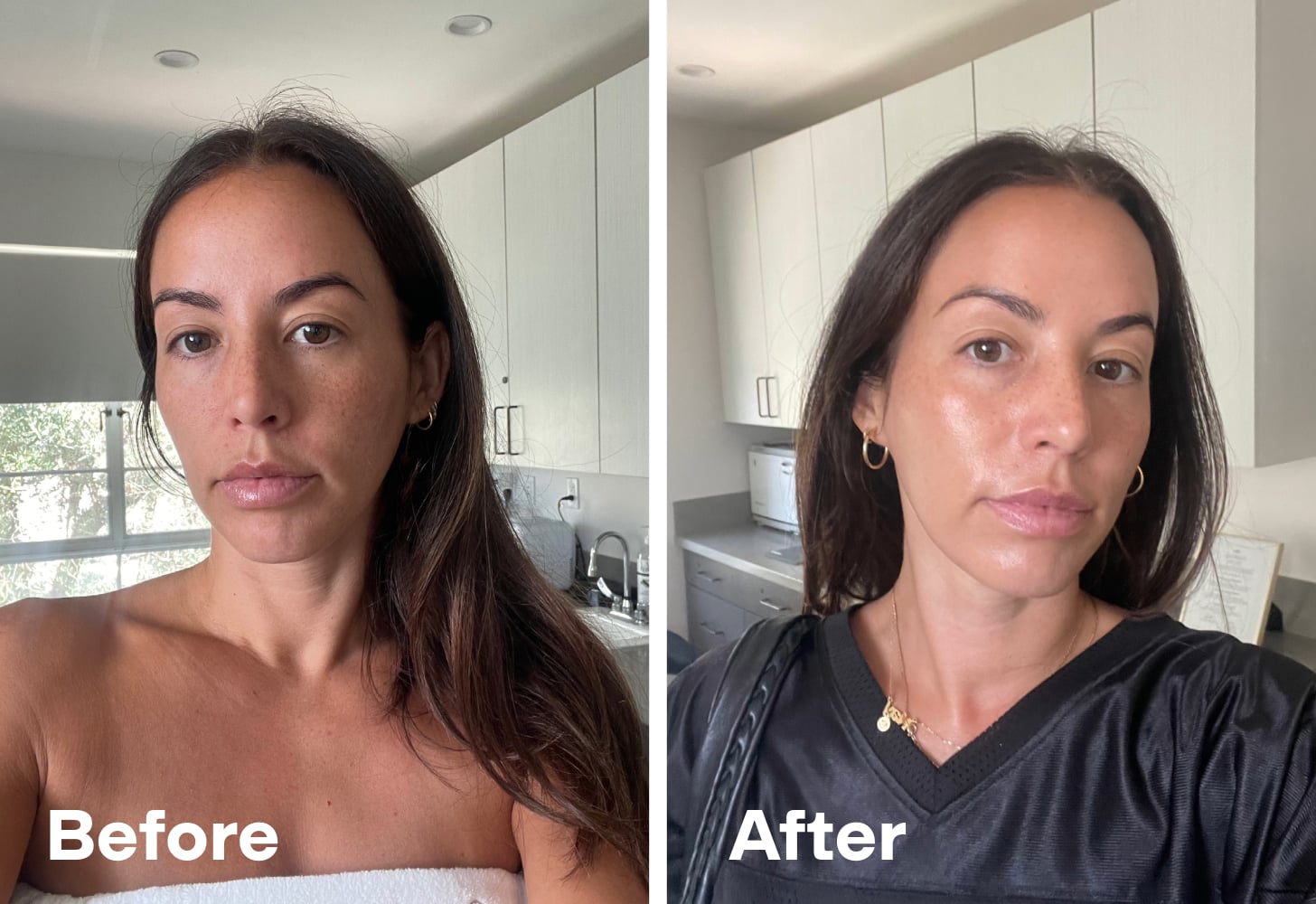 exo e before and after