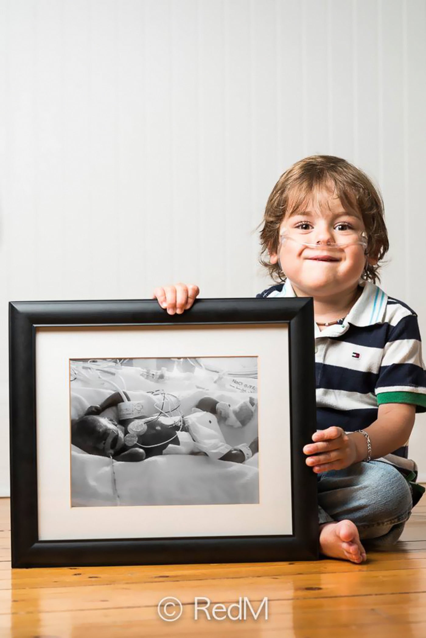 Then and Now Photos of Kids Who Were Born Premature | PS Family