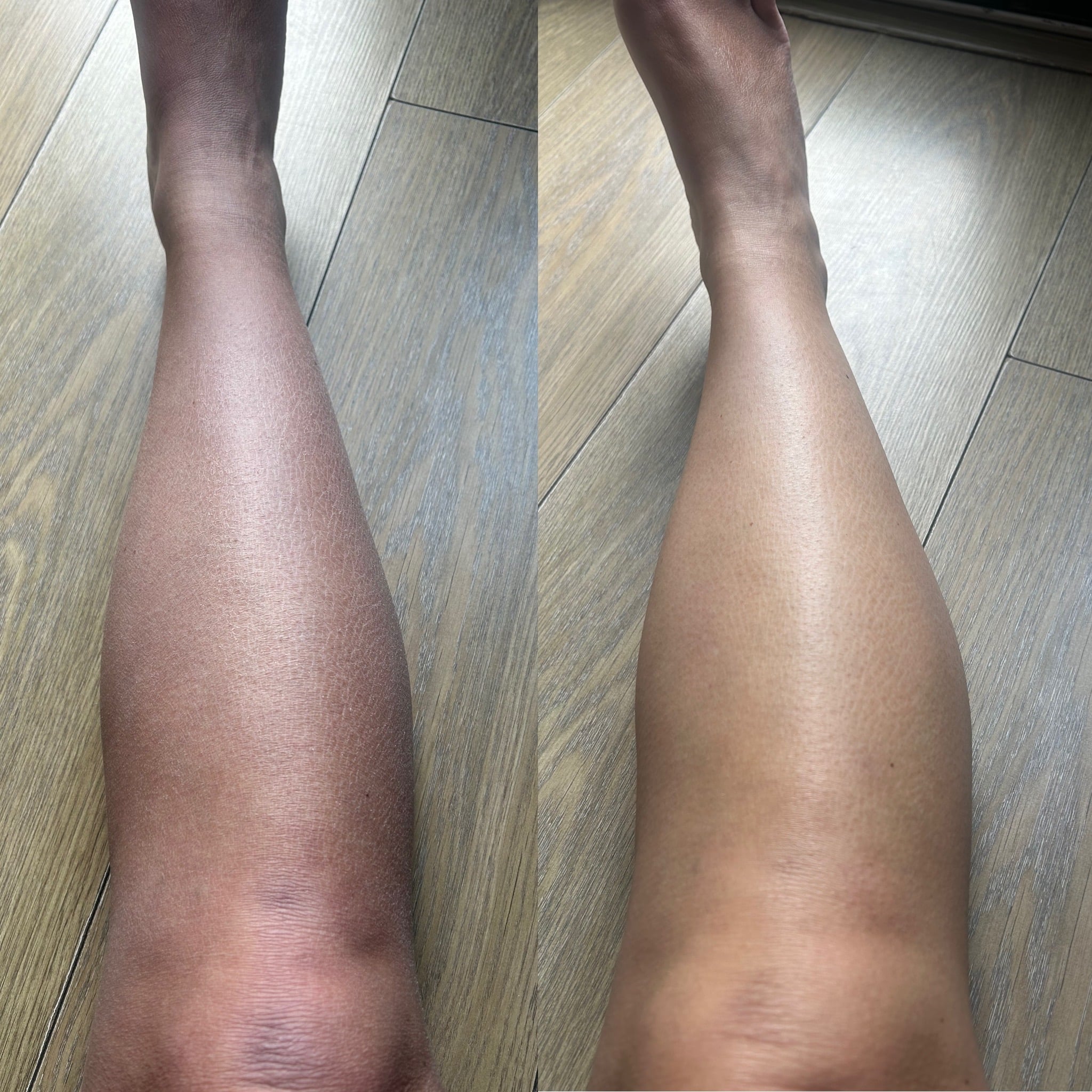 I Tried The Inkey List Body Stick: The Results Blew Me Away | POPSUGAR ...