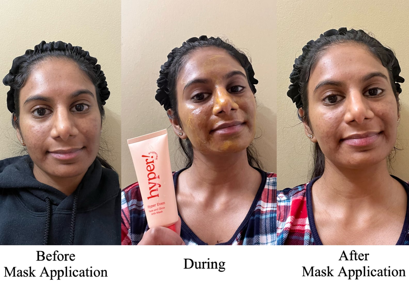 Hyper Even Fade and Glow AHA Mask Review With Photos | PS Beauty