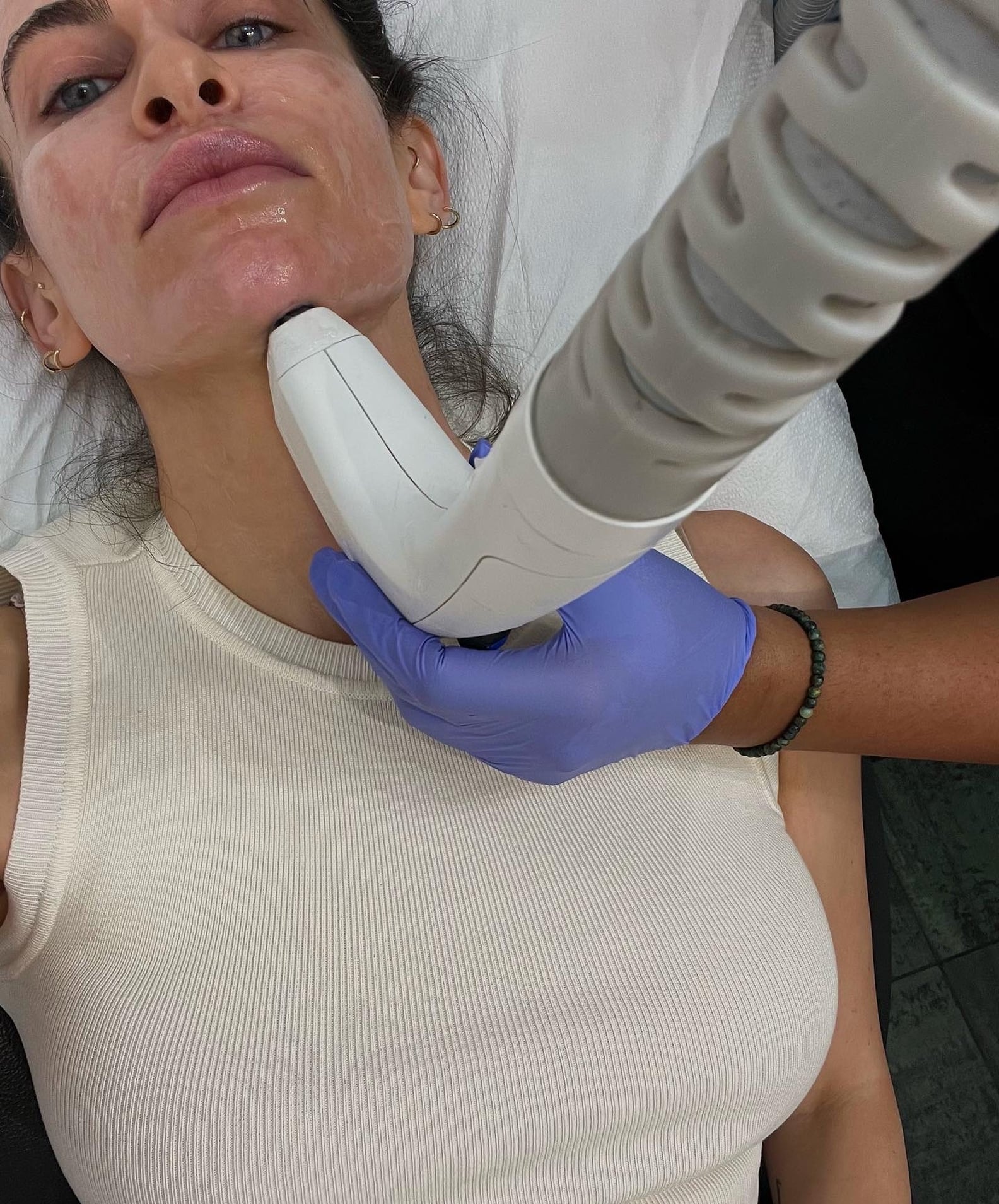 I Tried Sofwave, a New Skin-Tightening Treatment | PS Beauty