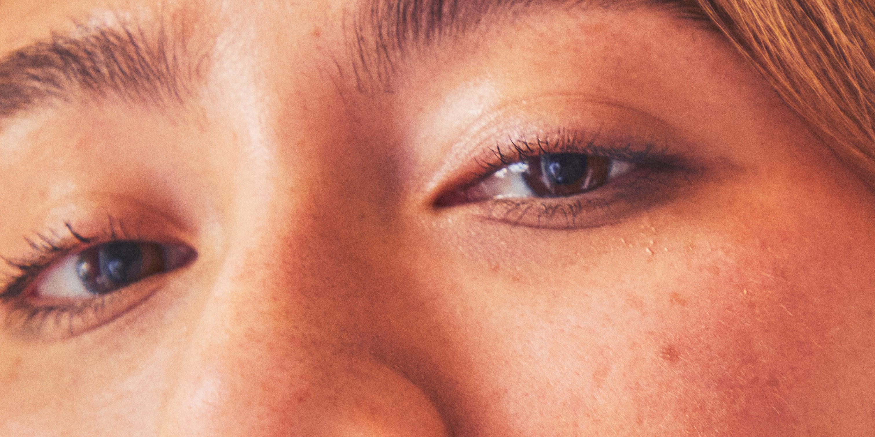 What Is Hypopigmentation? A Skin-Care Expert Explains | POPSUGAR Beauty