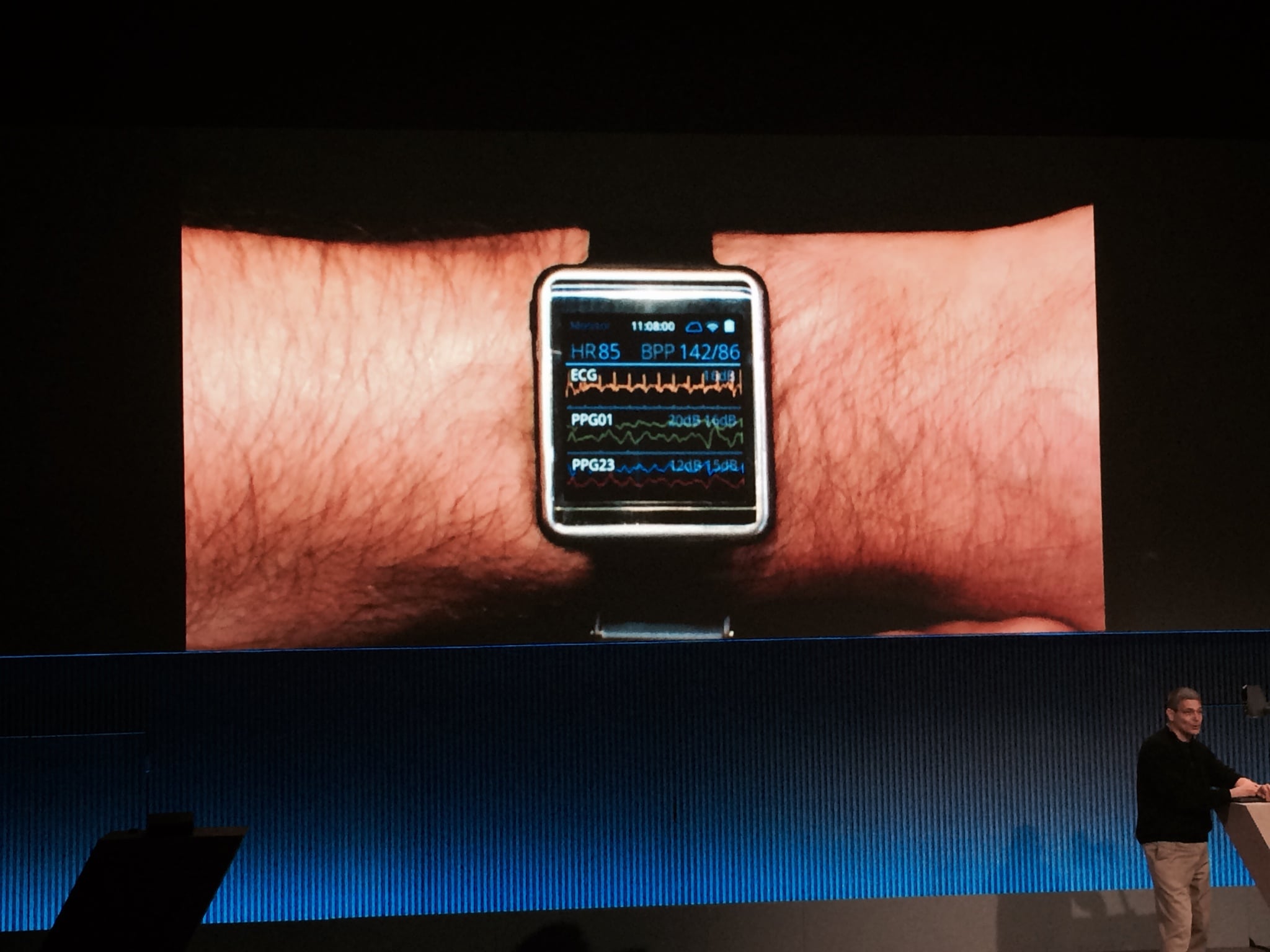 Samsung Simband Reference Hardware | POPSUGAR Tech