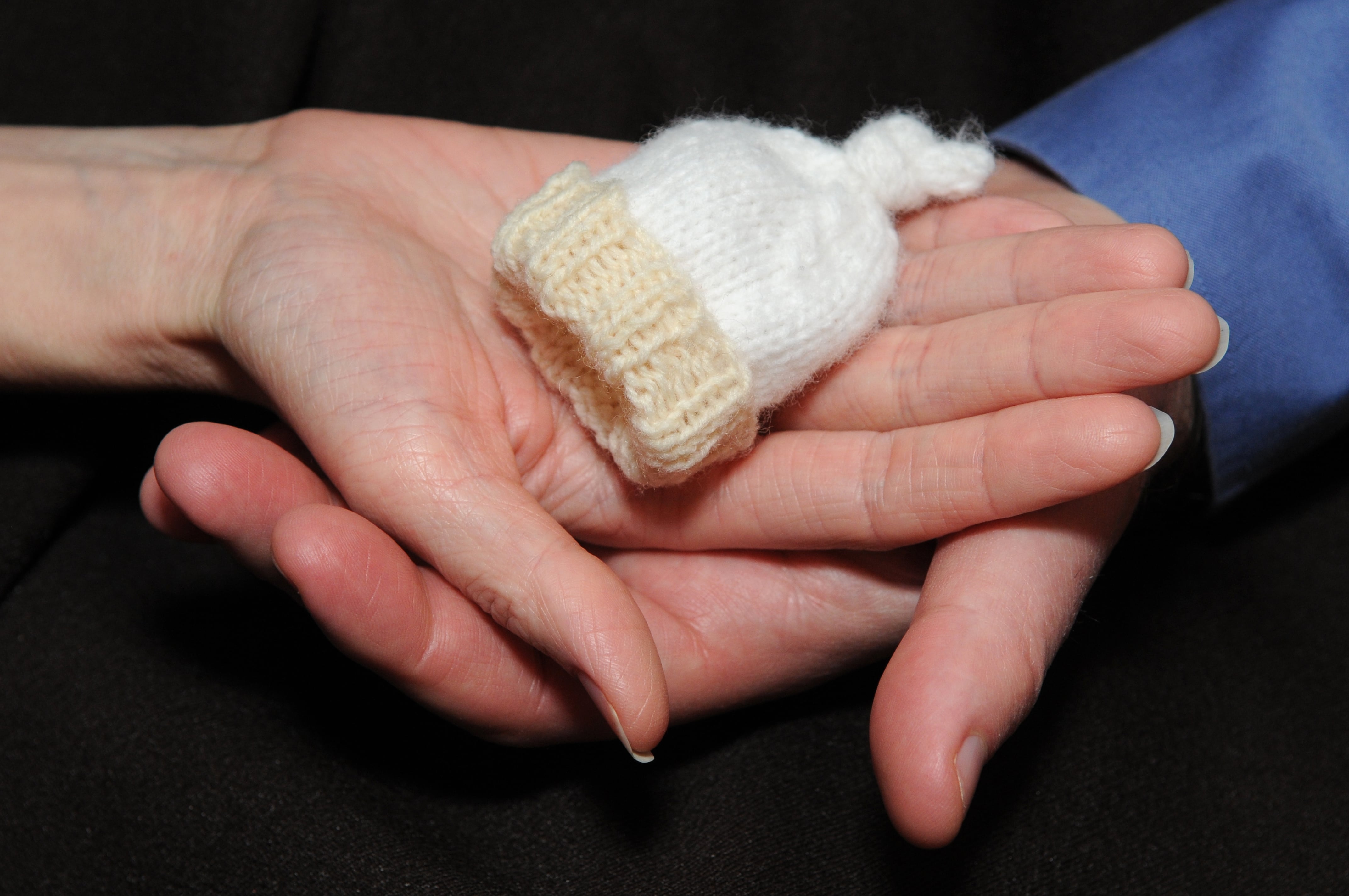 Breech Head Entrapment Birth Story | POPSUGAR Family